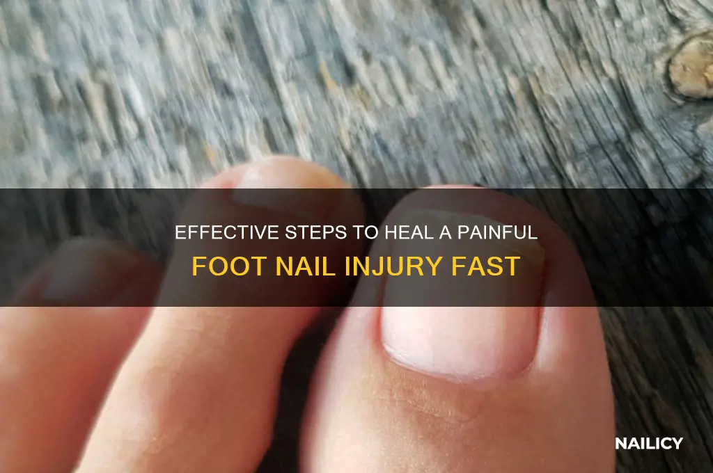 Effective Steps To Heal A Painful Foot Nail Injury Fast | Nailicy