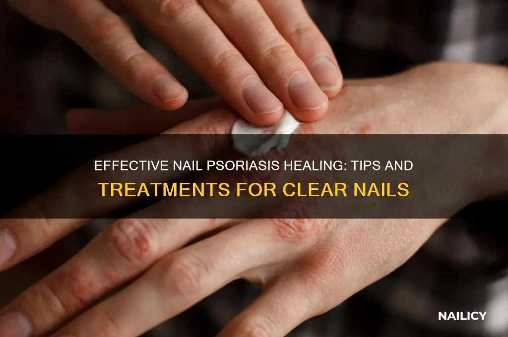 Effective Nail Psoriasis Healing: Tips And Treatments For Clear Nails ...