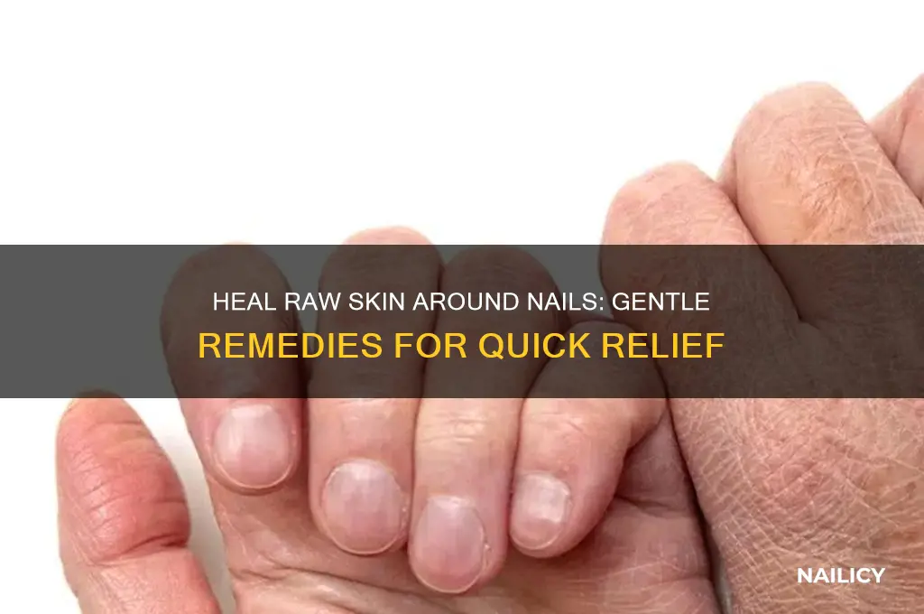 Heal Raw Skin Around Nails: Gentle Remedies For Quick Relief | Nailicy