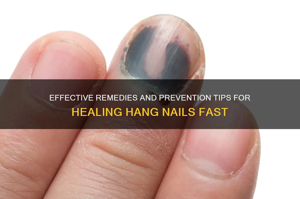 Effective Remedies And Prevention Tips For Healing Hang Nails Fast ...