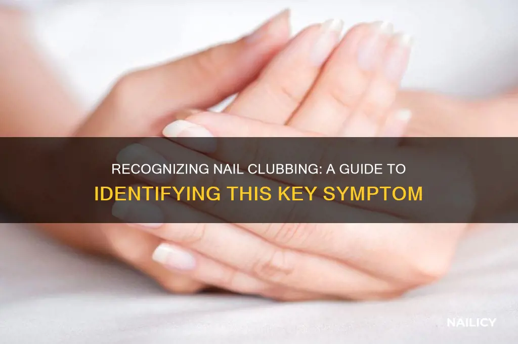 Recognizing Nail Clubbing: A Guide To Identifying This Key Symptom ...