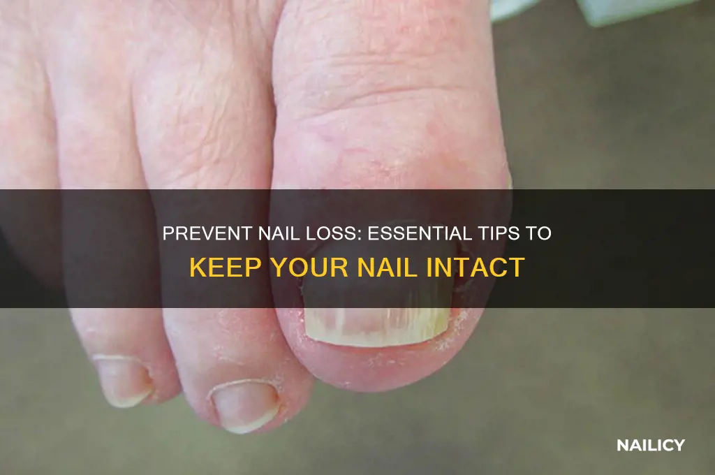 Prevent Nail Loss: Essential Tips To Keep Your Nail Intact | Nailicy