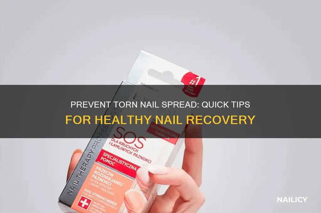 Prevent Torn Nail Spread: Quick Tips For Healthy Nail Recovery | Nailicy