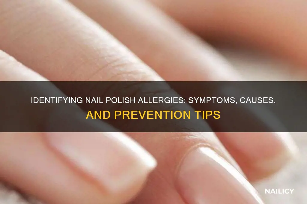 Identifying Nail Polish Allergies: Symptoms, Causes, And Prevention ...