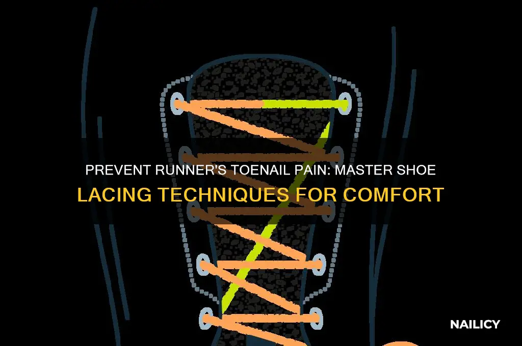 Prevent Runner's Toenail Pain: Master Shoe Lacing Techniques For ...