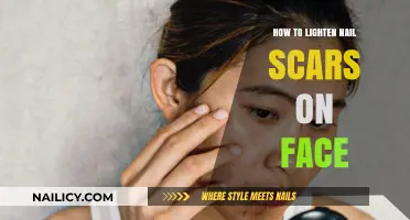 Effective Tips To Fade Nail Scars On Your Face Naturally | Nailicy
