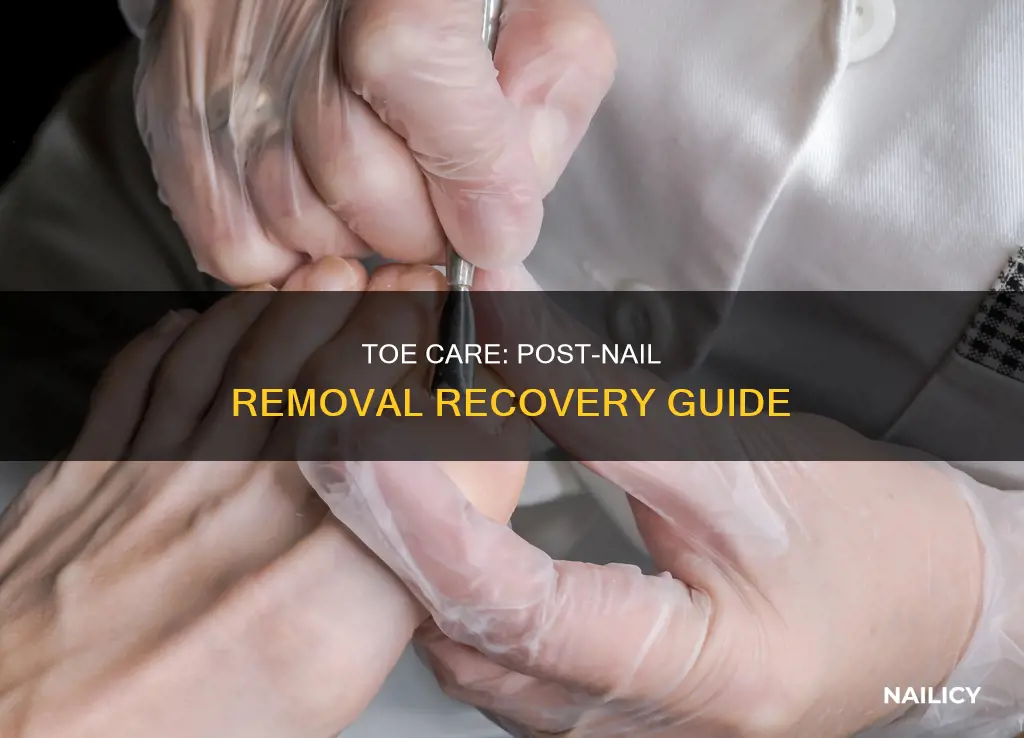 Toe Care: Post-Nail Removal Recovery Guide | Nailicy