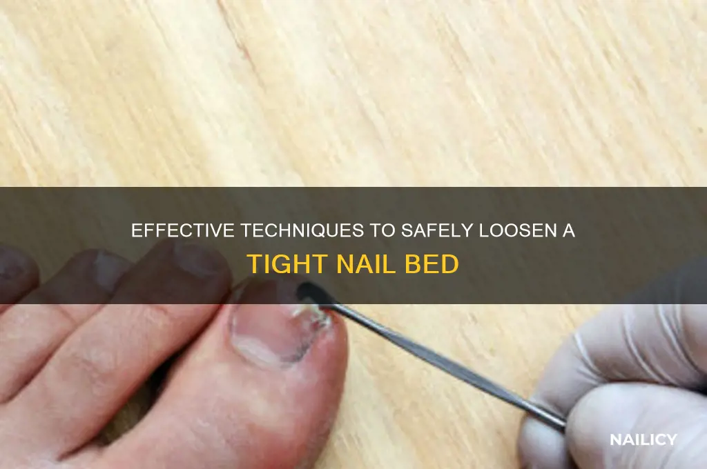 Effective Techniques To Safely Loosen A Tight Nail Bed | Nailicy