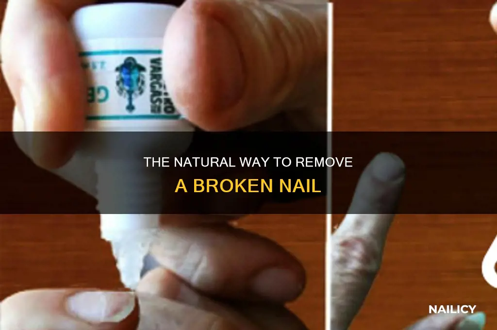 The Natural Way To Remove A Broken Nail | Nailicy