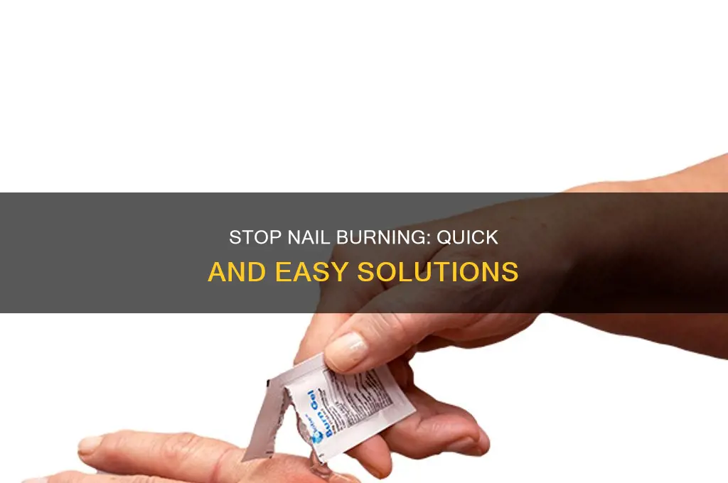 Stop Nail Burning: Quick And Easy Solutions | Nailicy
