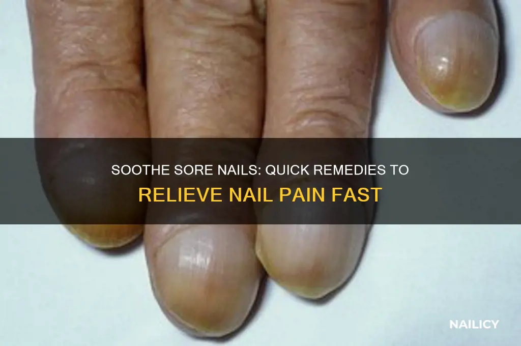 Soothe Sore Nails: Quick Remedies To Relieve Nail Pain Fast | Nailicy