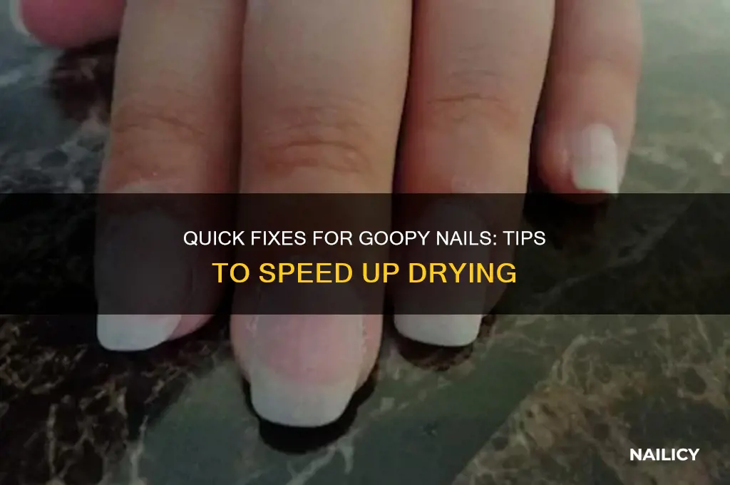 Quick Fixes For Goopy Nails: Tips To Speed Up Drying | Nailicy