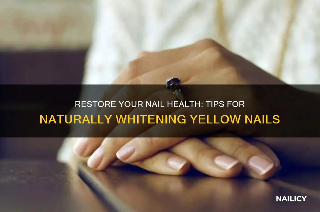 Restore Your Nail Health: Tips For Naturally Whitening Yellow Nails ...