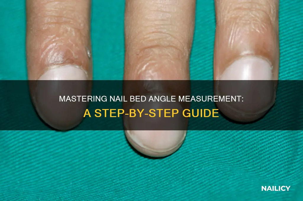 Mastering Nail Bed Angle Measurement: A Step-By-Step Guide | Nailicy