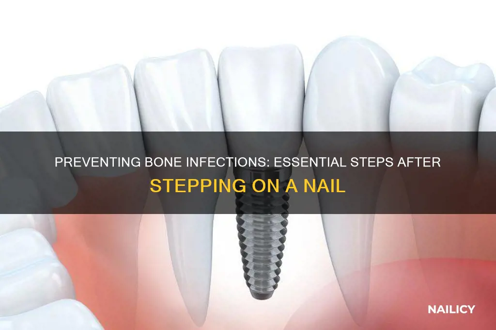 Preventing Bone Infections: Essential Steps After Stepping On A Nail ...