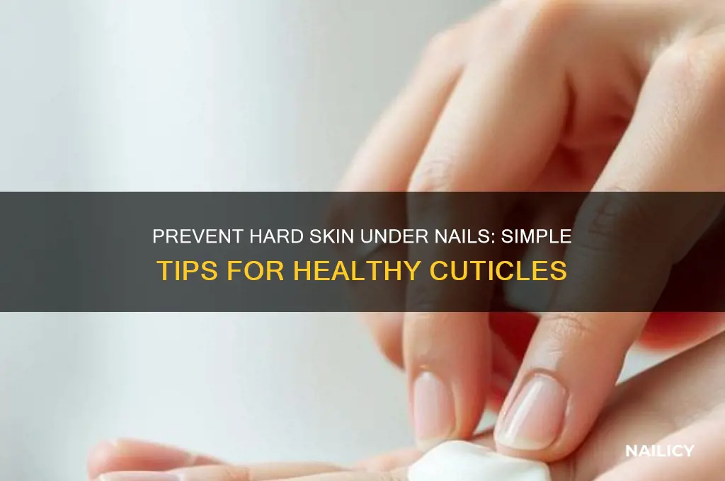Prevent Hard Skin Under Nails: Simple Tips For Healthy Cuticles | Nailicy