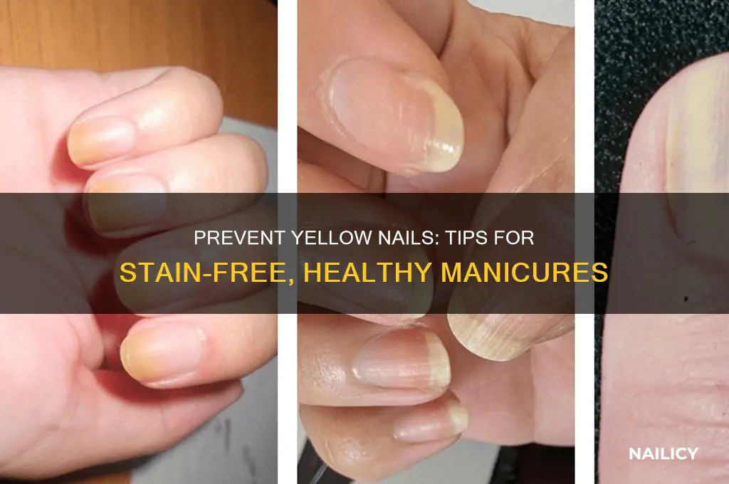 Prevent Yellow Nails: Tips For Stain-Free, Healthy Manicures | Nailicy