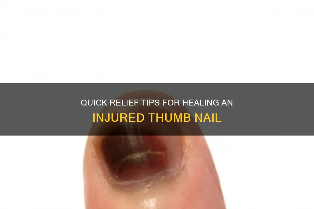 Quick Relief Tips For Healing An Injured Thumb Nail | Nailicy