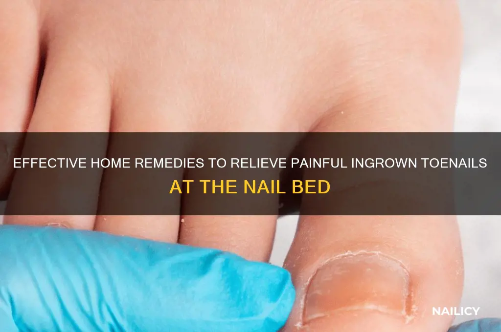 Effective Home Remedies To Relieve Painful Ingrown Toenails At The Nail ...