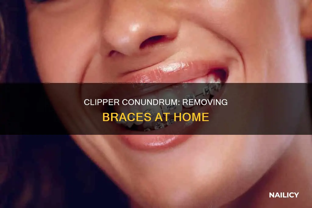 Clipper Conundrum: Removing Braces At Home | Nailicy