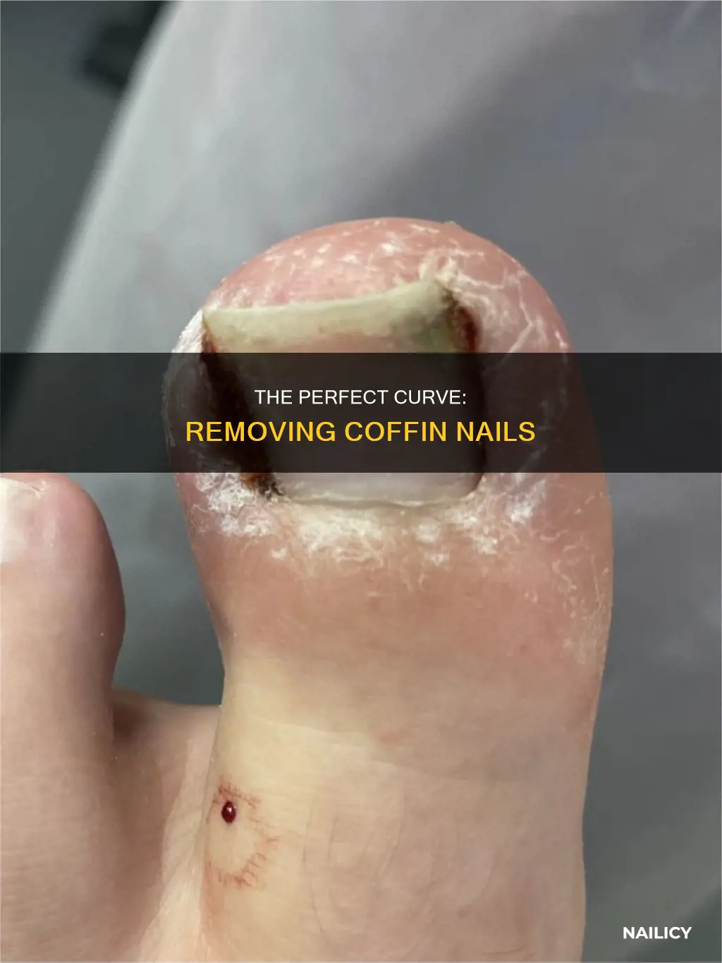 The Perfect Curve: Removing Coffin Nails | Nailicy