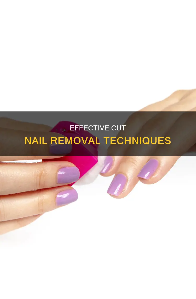 Effective Cut Nail Removal Techniques | Nailicy