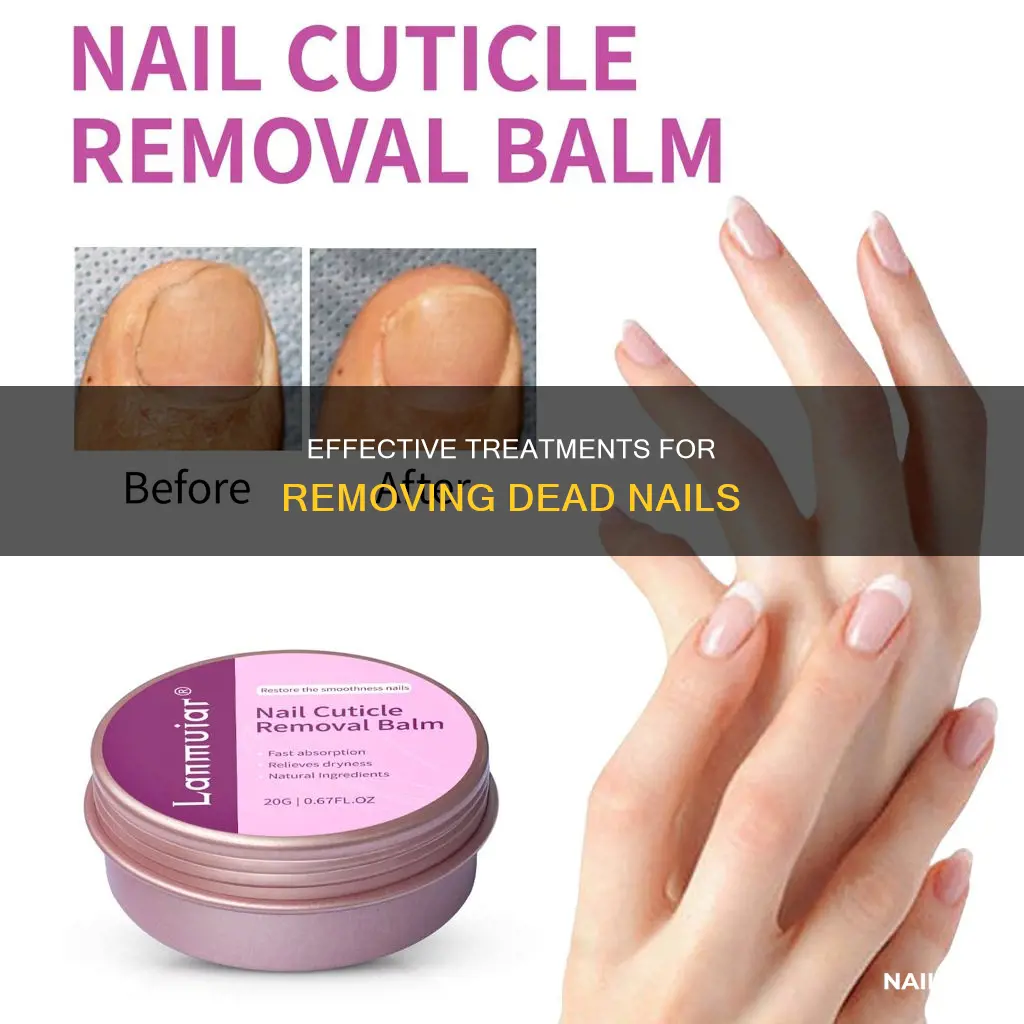 Effective Treatments For Removing Dead Nails | Nailicy