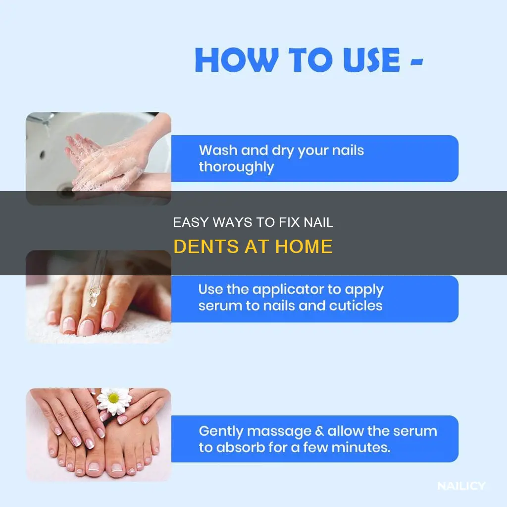 Easy Ways To Fix Nail Dents At Home | Nailicy