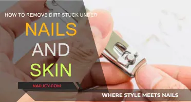 Get Rid Of Dirty Nails: Effective Methods | Nailicy