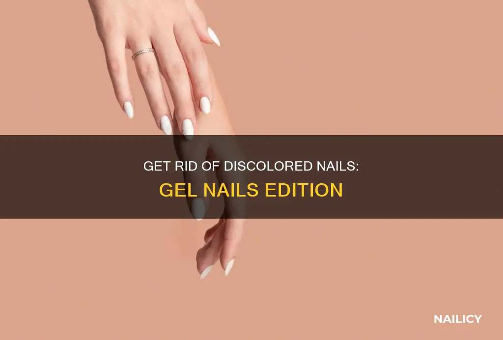Get Rid Of Discolored Nails: Gel Nails Edition | Nailicy