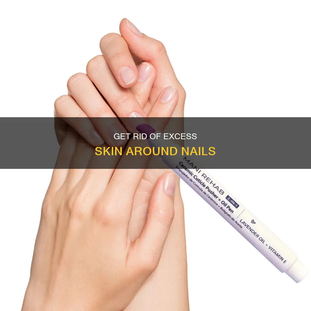 Get Rid Of Excess Skin Around Nails | Nailicy