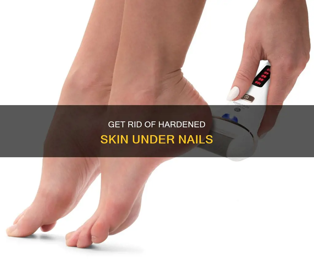 Get Rid Of Hardened Skin Under Nails | Nailicy