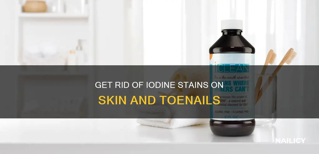 Get Rid Of Iodine Stains On Skin And Toenails | Nailicy