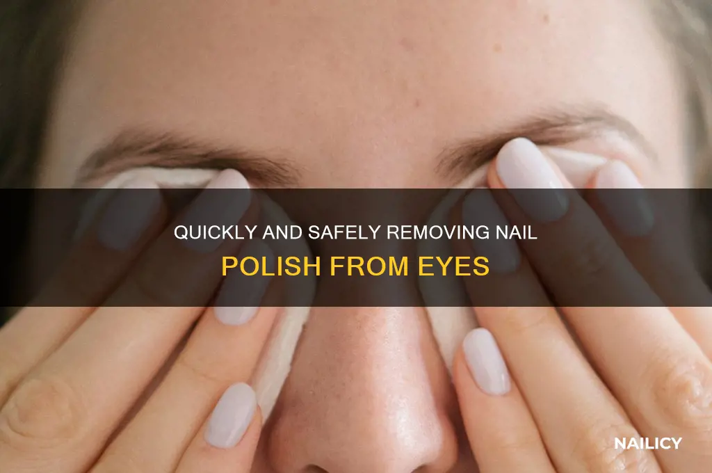 Quickly And Safely Removing Nail Polish From Eyes | Nailicy