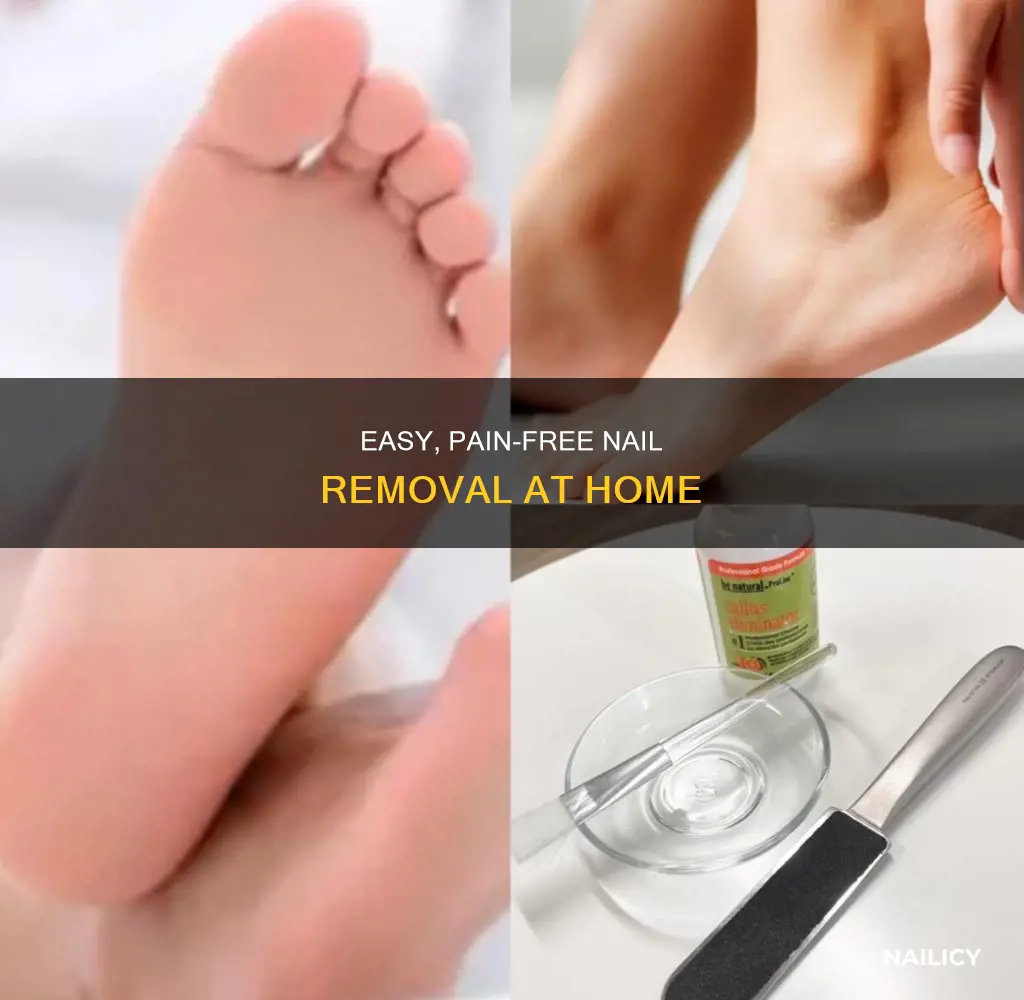 Easy, Pain-Free Nail Removal At Home | Nailicy