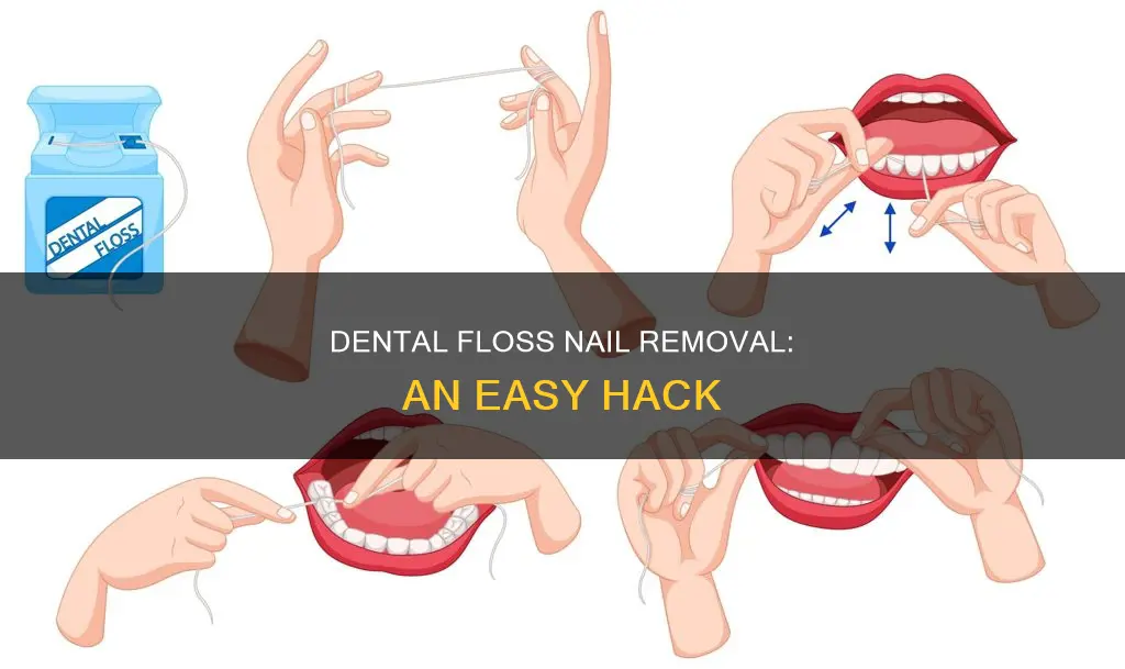 Dental Floss Nail Removal: An Easy Hack | Nailicy