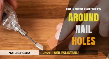 Removing Splinter Painlessly From Under Nail | Nailicy