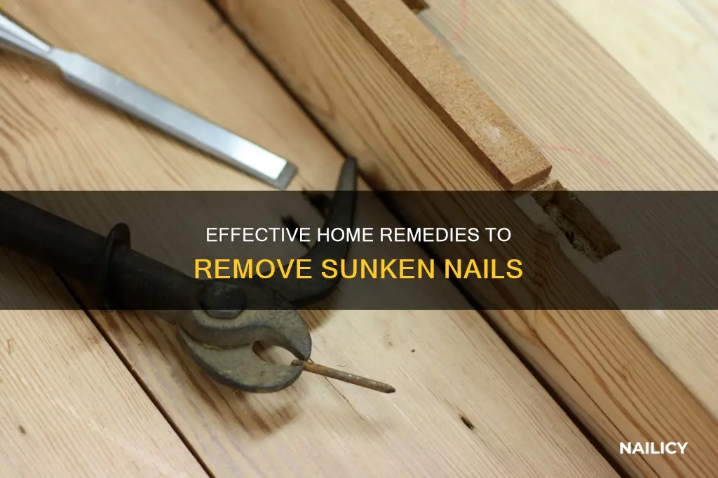 Effective Home Remedies To Remove Sunken Nails | Nailicy