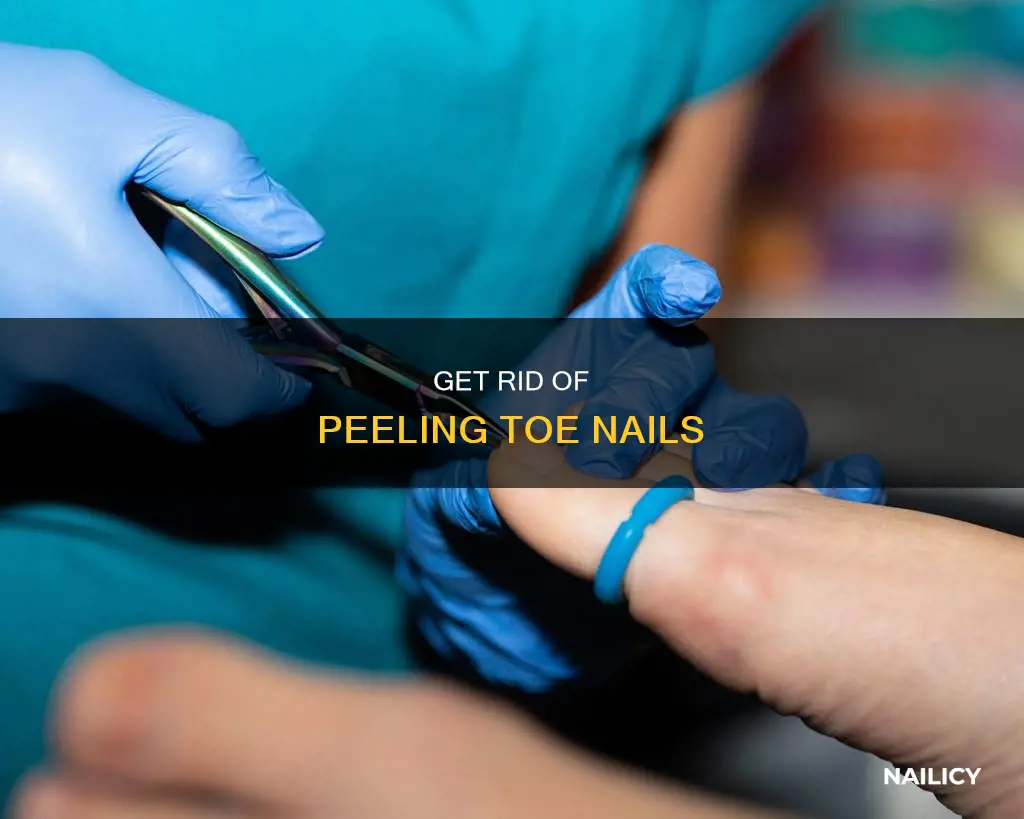 Get Rid Of Peeling Toe Nails | Nailicy