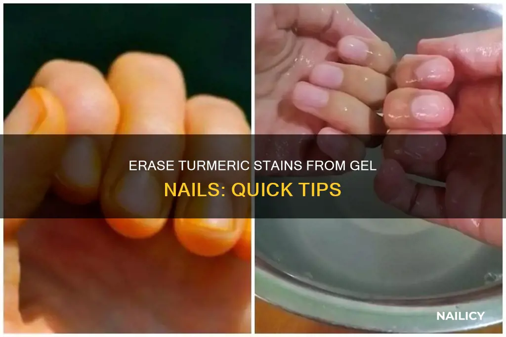 Erase Turmeric Stains From Gel Nails: Quick Tips | Nailicy