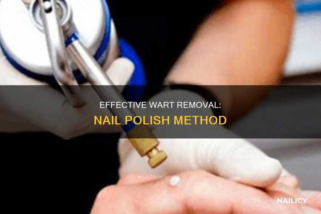 Effective Wart Removal: Nail Polish Method | Nailicy