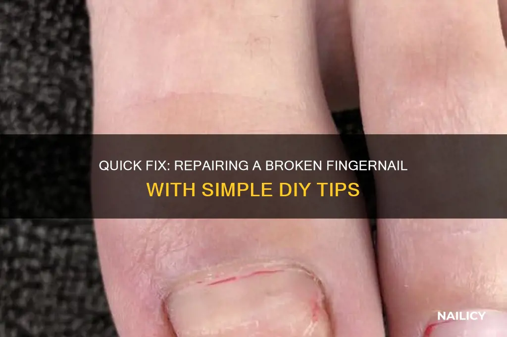 Quick Fix: Repairing A Broken Fingernail With Simple Diy Tips | Nailicy