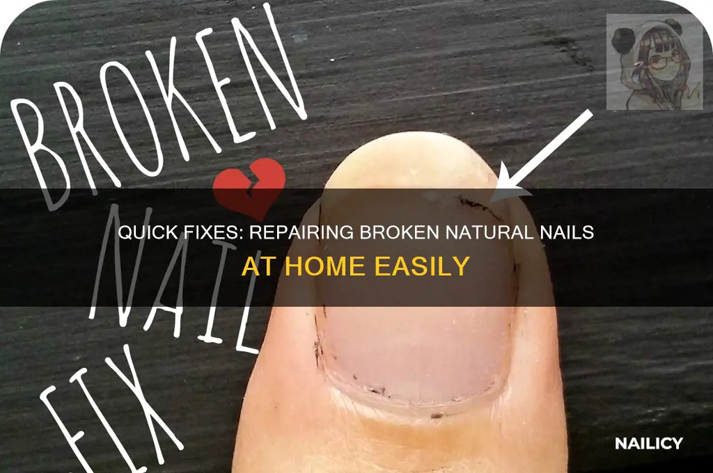 Quick Fixes: Repairing Broken Natural Nails At Home Easily | Nailicy