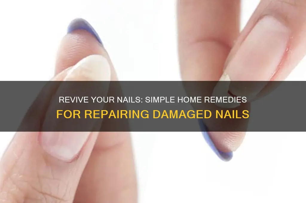 Revive Your Nails: Simple Home Remedies For Repairing Damaged Nails ...