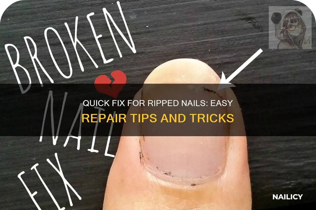Quick Fix For Ripped Nails: Easy Repair Tips And Tricks | Nailicy