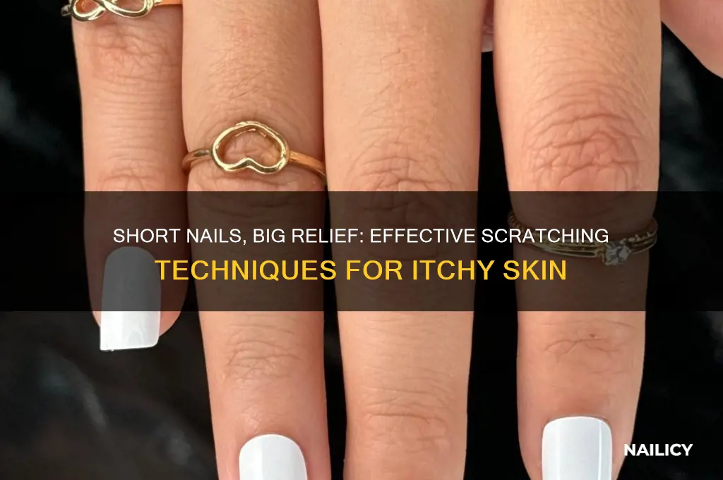 Short Nails, Big Relief: Effective Scratching Techniques For Itchy Skin ...