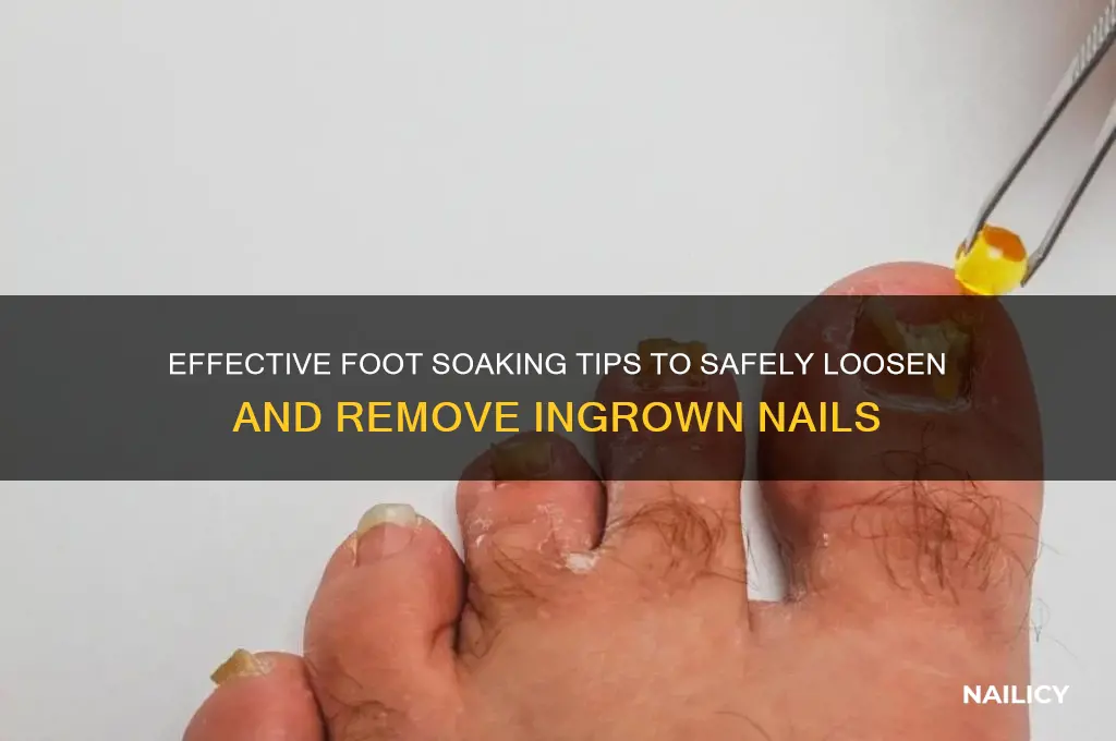 Effective Foot Soaking Tips To Safely Loosen And Remove Ingrown Nails ...