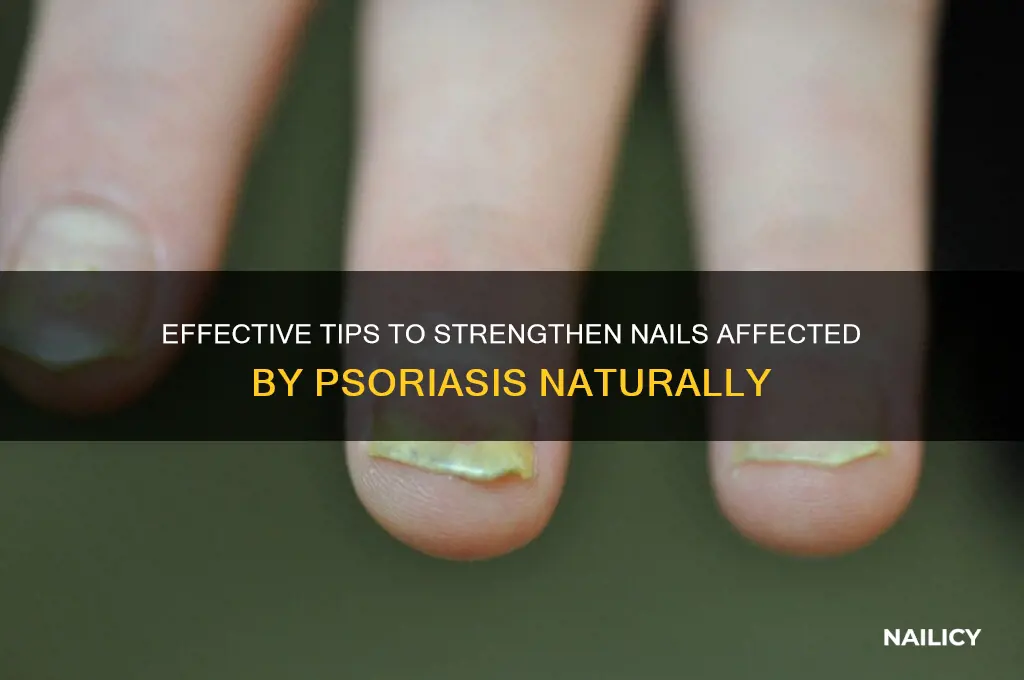 Effective Tips To Strengthen Nails Affected By Psoriasis Naturally ...