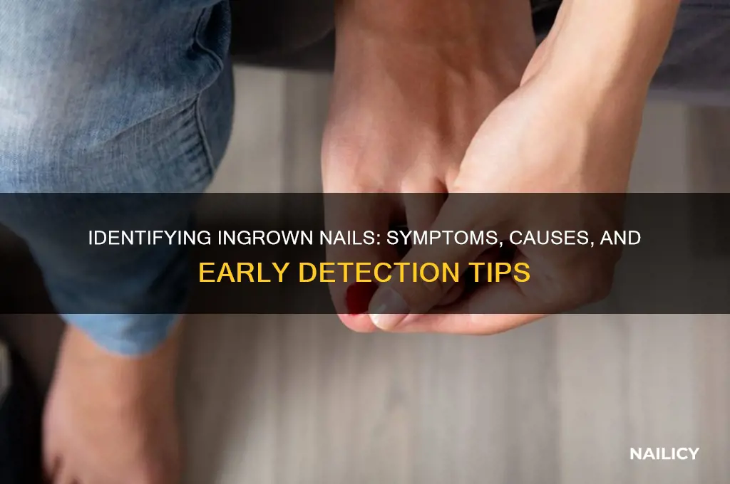 Identifying Ingrown Nails: Symptoms, Causes, And Early Detection Tips ...