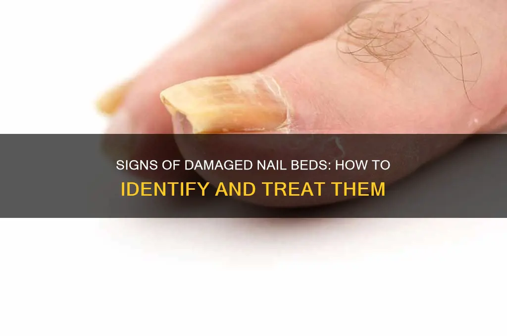 Signs Of Damaged Nail Beds: How To Identify And Treat Them | Nailicy